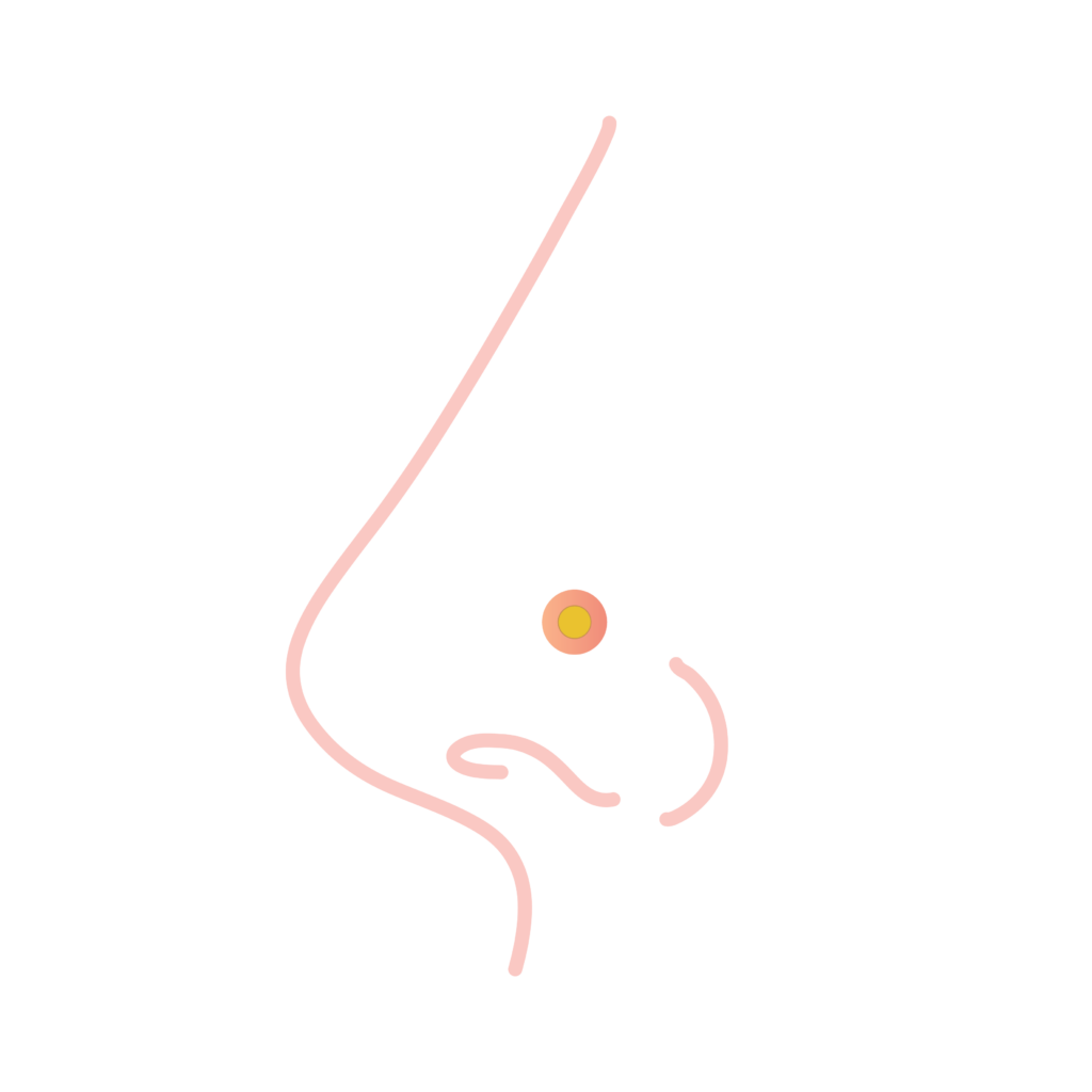 How to Get Rid of a Piercing Bump - Essential Beauty & Piercing