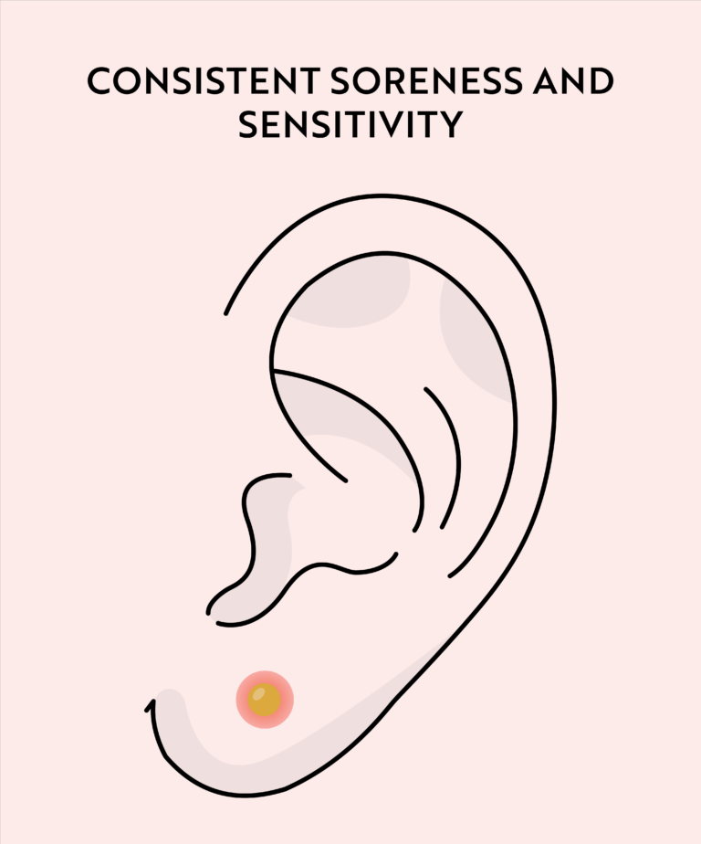 Signs of Piercing Migration & More - Essential Beauty & Piercing Signs of Piercing Migration & More - Essential Beauty & Piercing