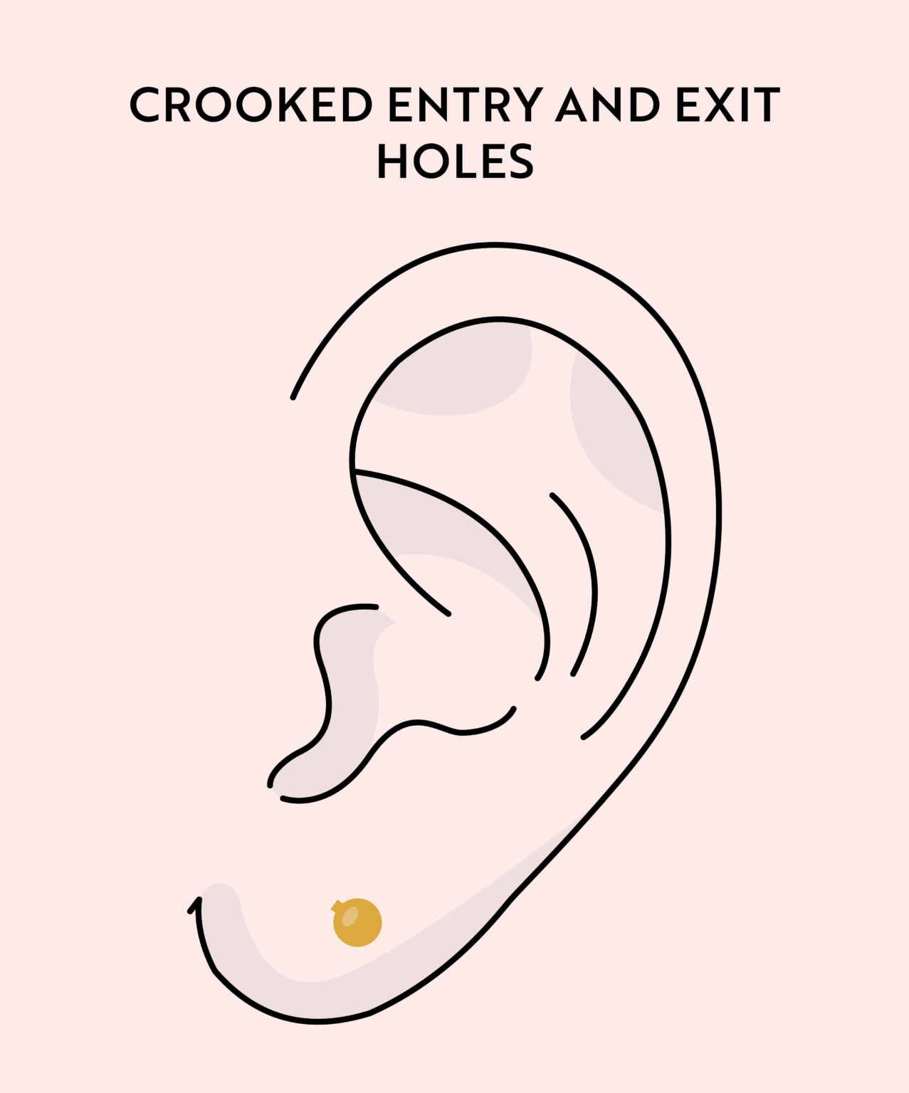 Signs of Piercing Migration & More - Essential Beauty & Piercing