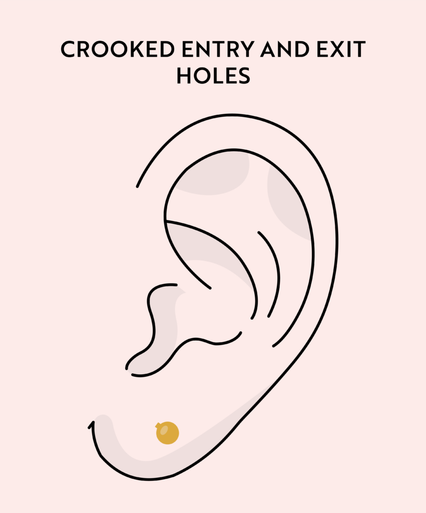 Signs of Piercing Migration & More - Essential Beauty & Piercing Signs of Piercing Migration & More - Essential Beauty & Piercing