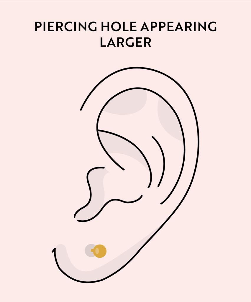 Signs of Piercing Migration & More - Essential Beauty & Piercing Signs of Piercing Migration & More - Essential Beauty & Piercing
